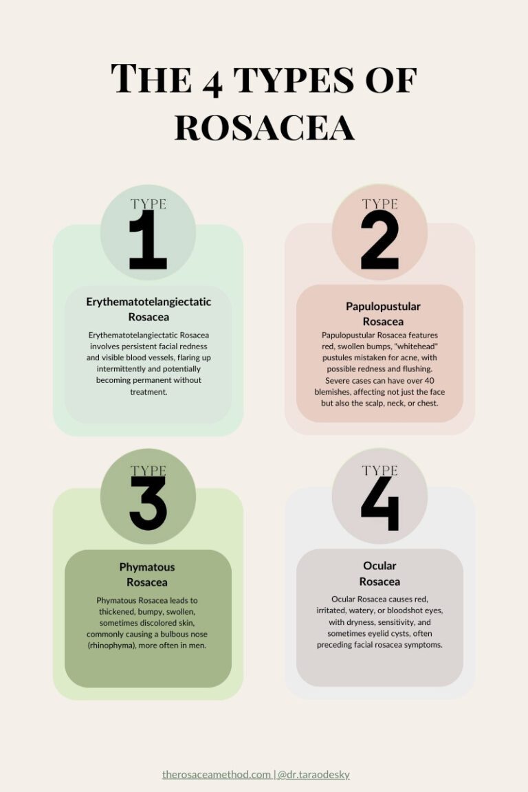 4 Types of Rosacea + Natural Treatments | The Rosacea Method